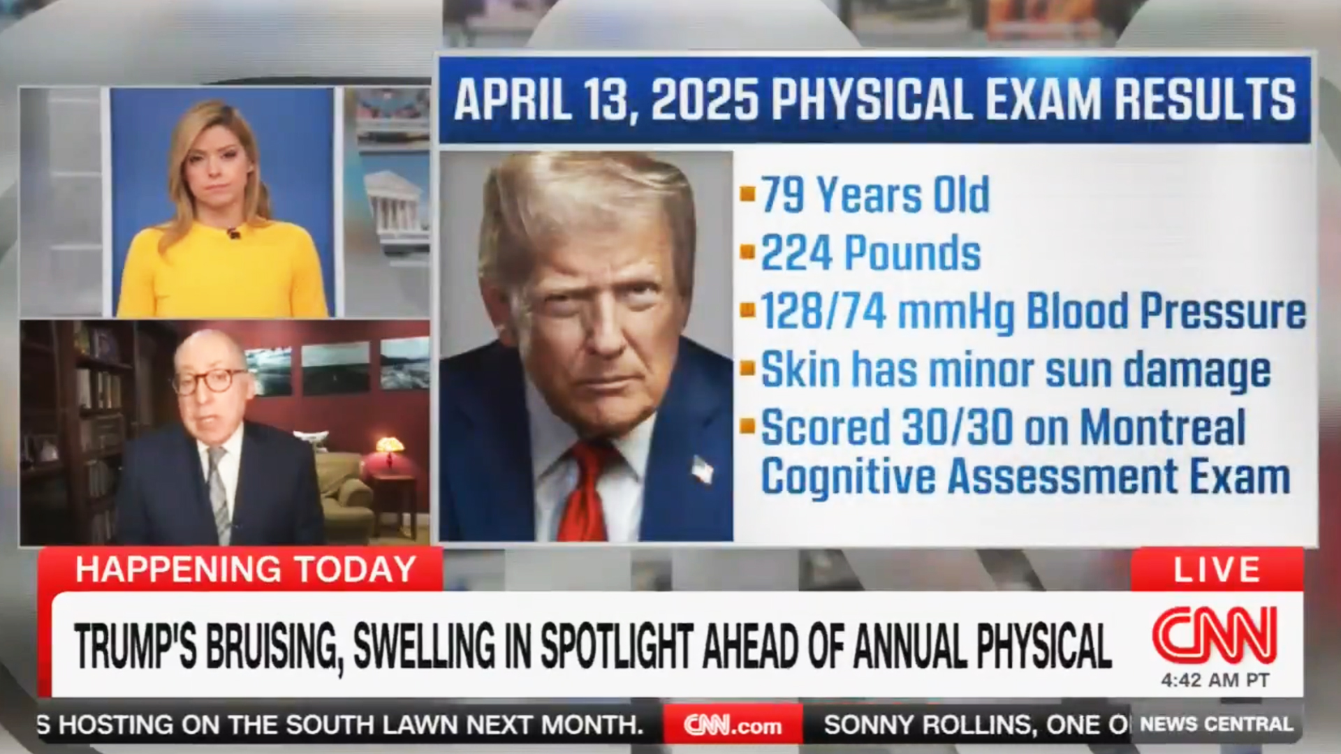 Doctors warns about Trump's lack of sleep