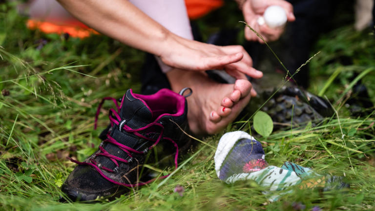 6 types of hiking foot pain and what they mean for your trip
