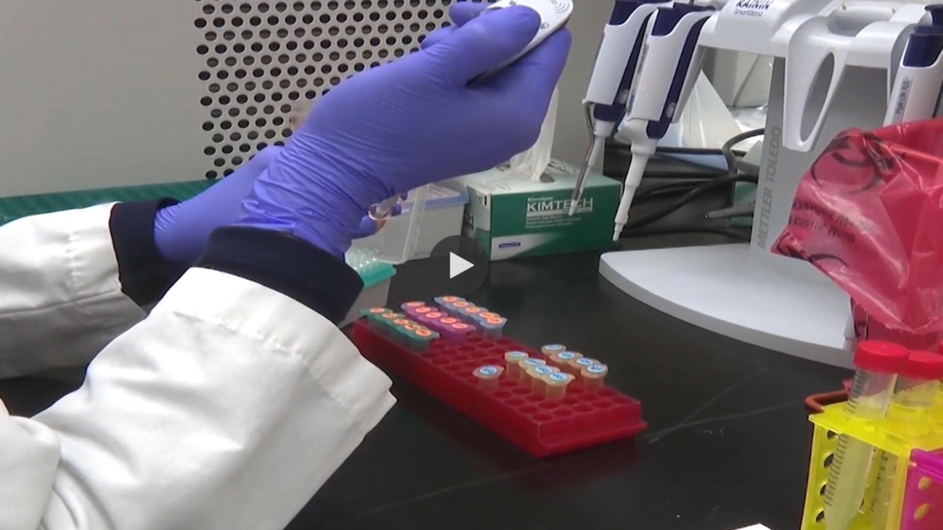 American Cancer Society endorses blood tests as option for colorectal ...
