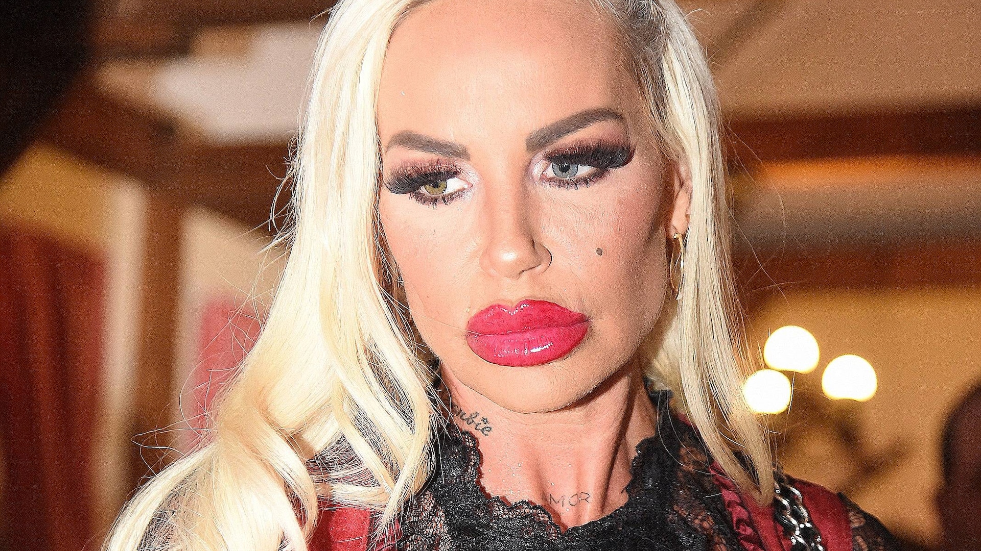 Gina-Lisa Lohfink hatte nach verpfuschter Beauty-OP Angst, mein Bein zu ...