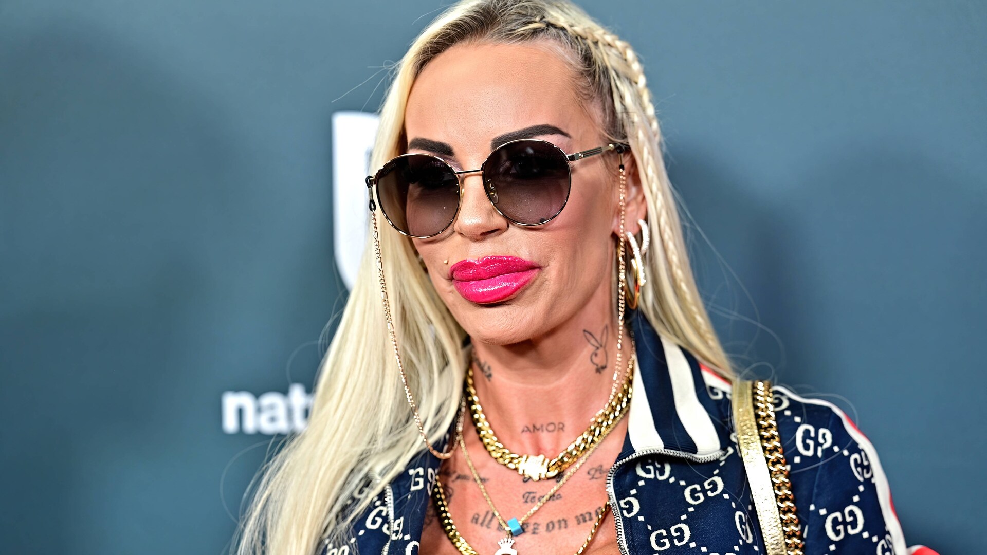 Gina-Lisa Lohfink: „Ich habe Angst, dass Bakterien mein Bein von innen ...