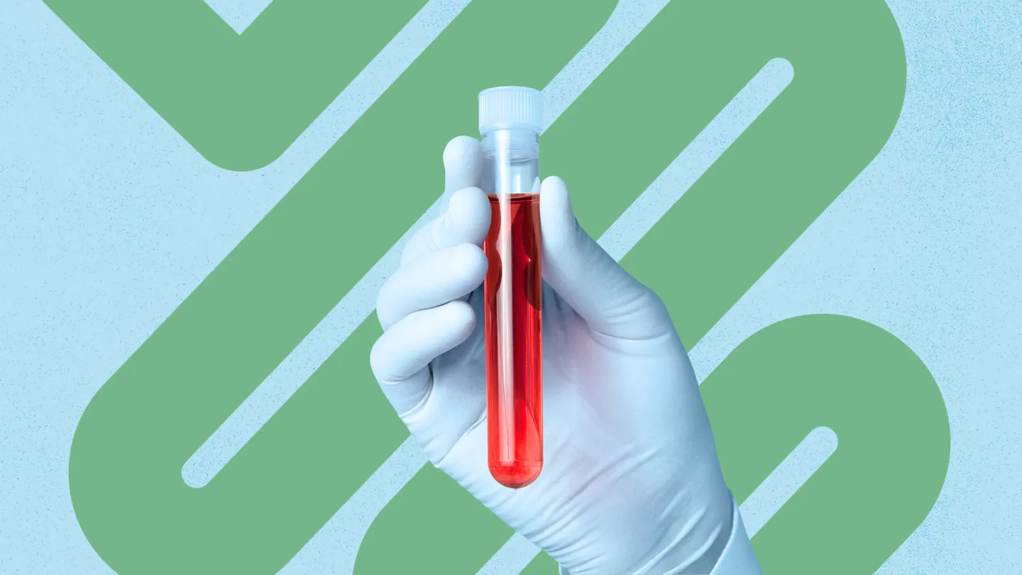 Putting off your colonoscopy? Now you can get a blood test instead