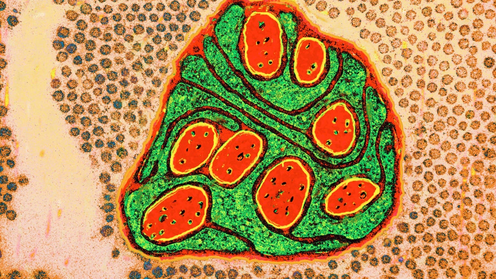 Experts warn of overlooked signs of calcium deficiency