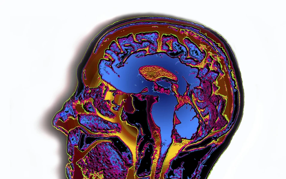 How to train your brain for real confidence