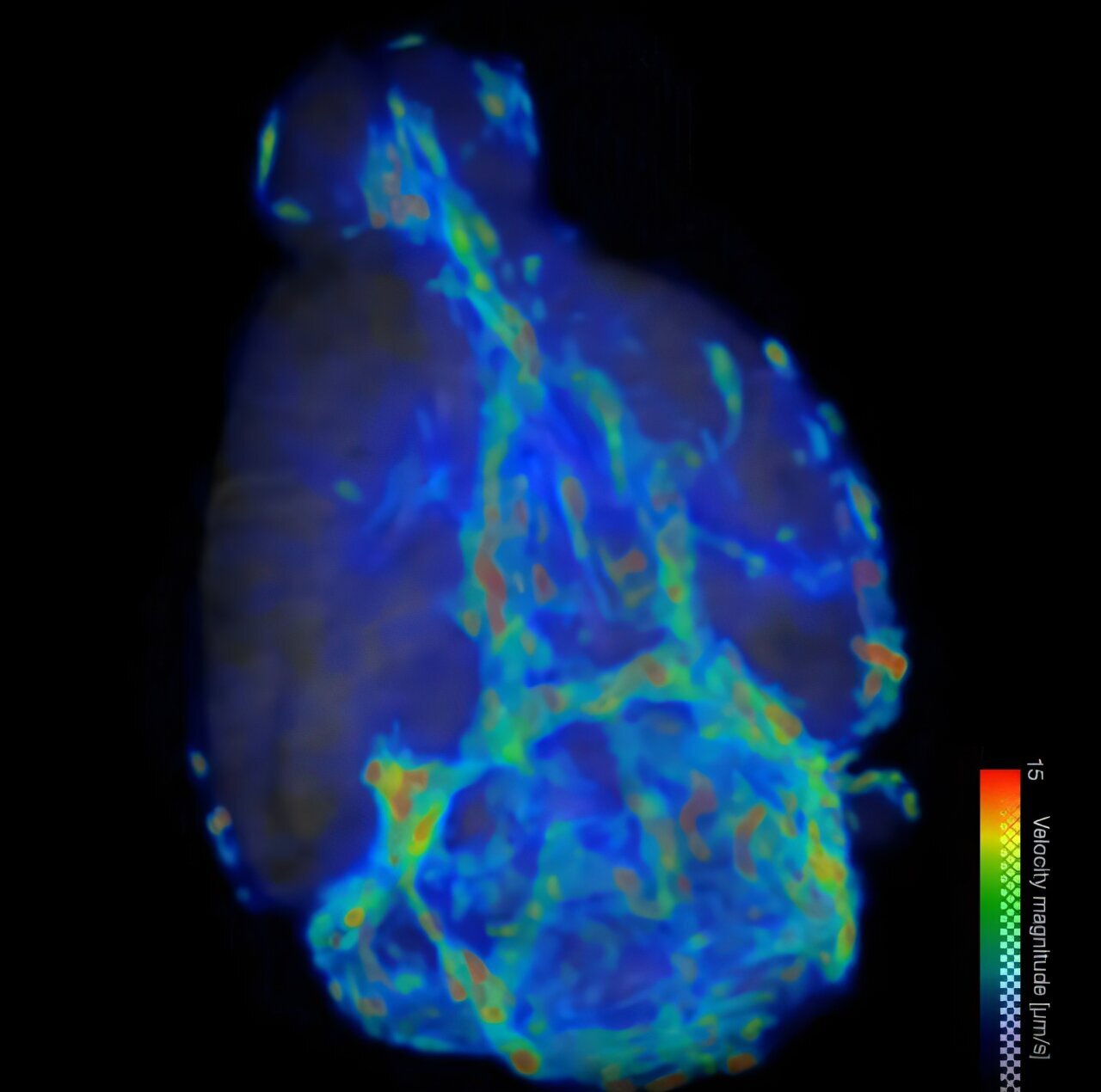 AI maps brain waste-clearing flow, revealing two speeds tied to deep sleep