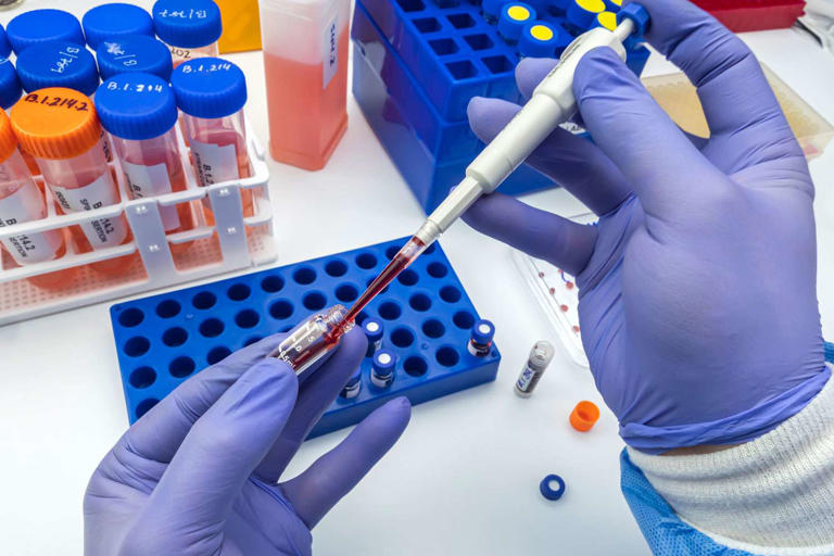 New blood test added to colorectal cancer screening recommendations as ...