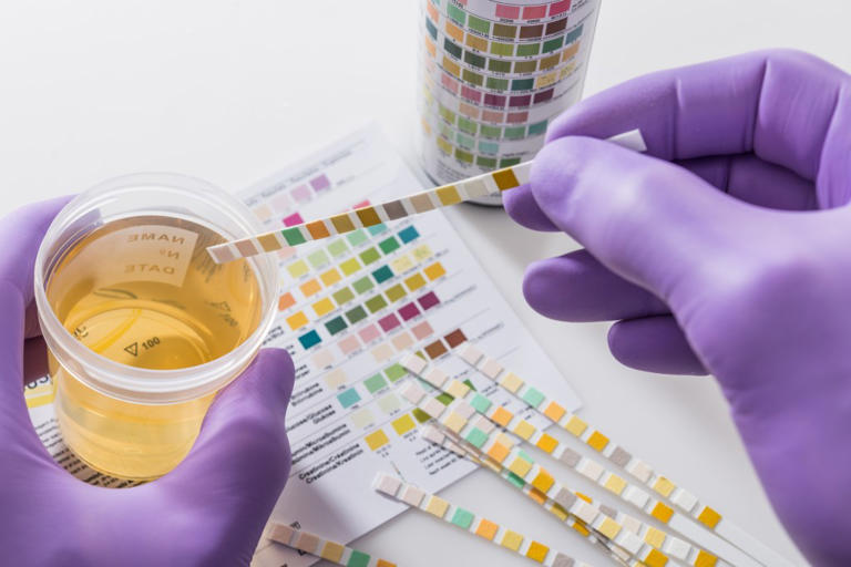 New urine test could diagnose autism in children: study