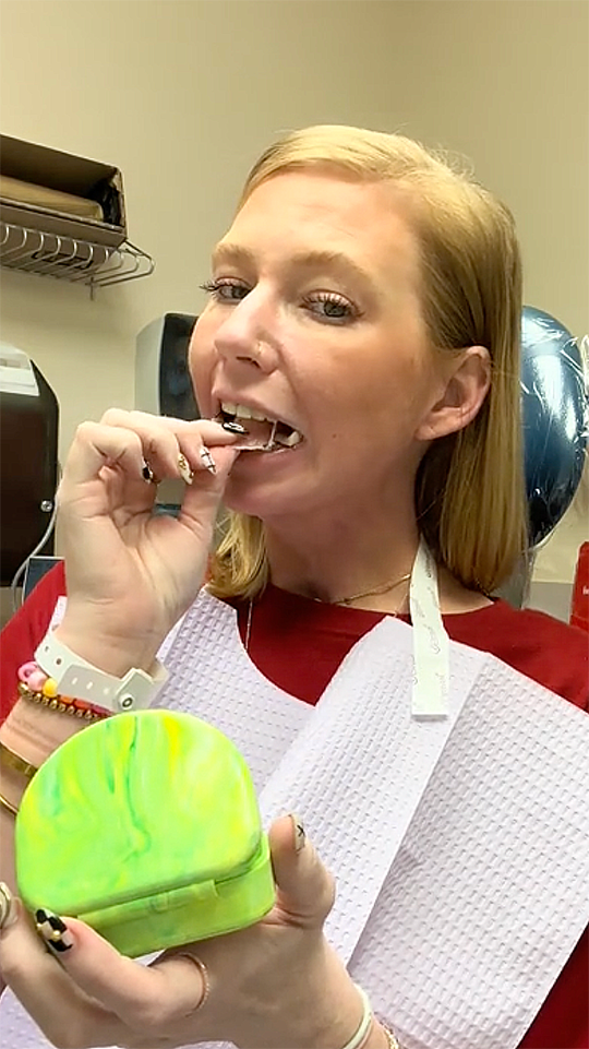 Getting my prosthetic tongue installed 🤯