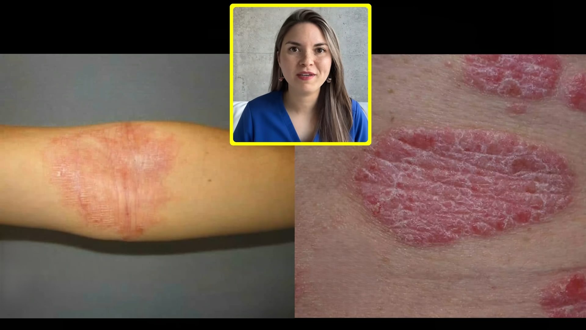 Your skin could reveal cancer, autoimmune disease, or diabetes