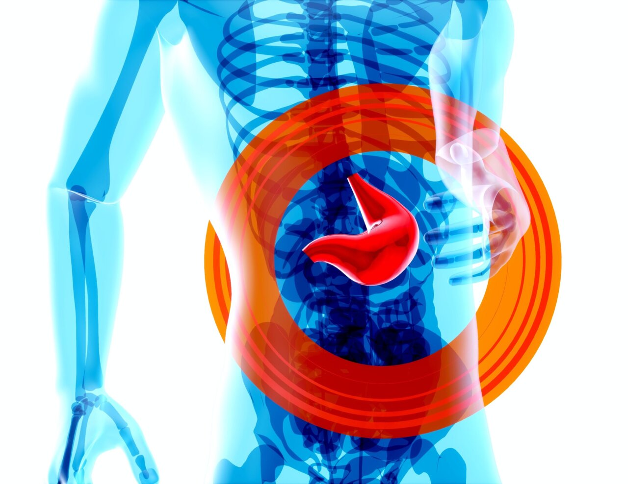 Years after polyp removal, gut microbiome changes may still shape ...