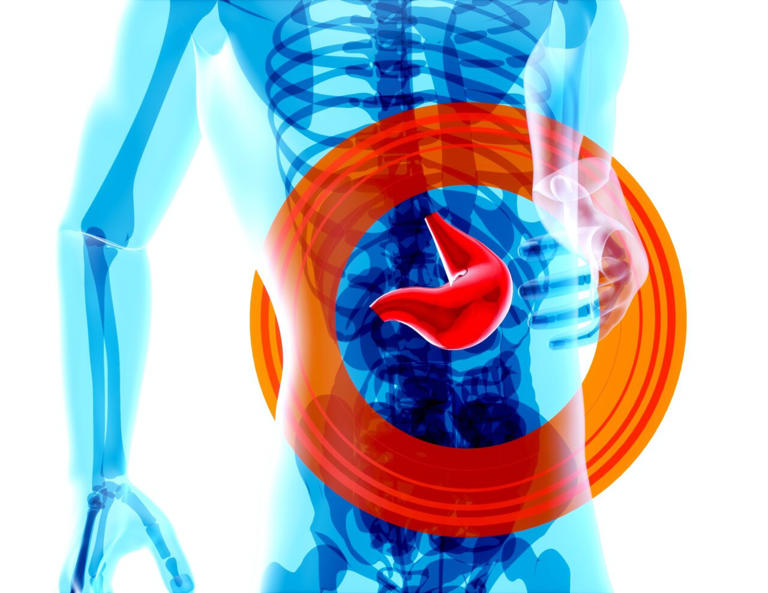 Years after polyp removal, gut microbiome changes may still shape ...