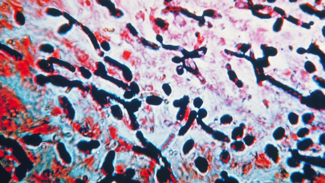 Why fungal infections are getting harder to fight