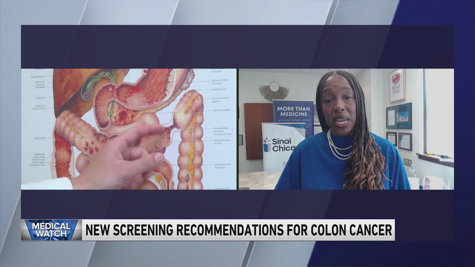 Blood test added to screening guidelines for colorectal cancers for ...