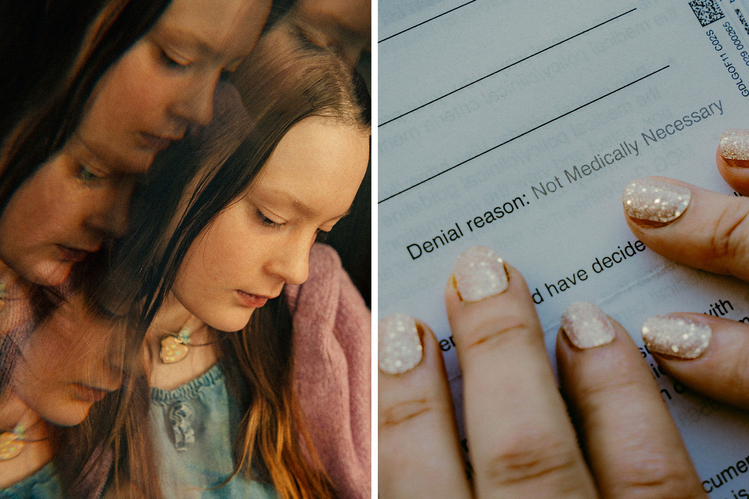 When drug after drug failed, a teen hoped brain surgery could fix her ...