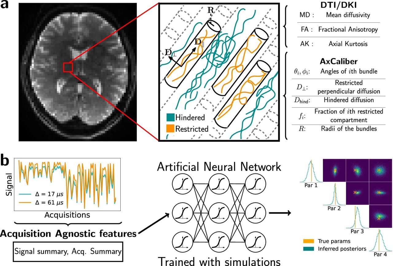 AI and simulations cut advanced brain MRI time by up to 90%