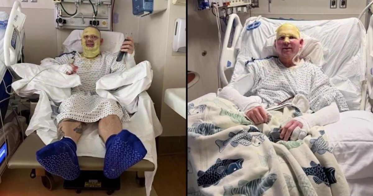 'I'm happy to be alive': Garner man severely burned from boat fire ...