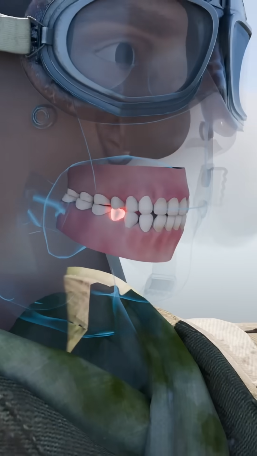 How Thin Air Shattered Soldier Teeth Apart