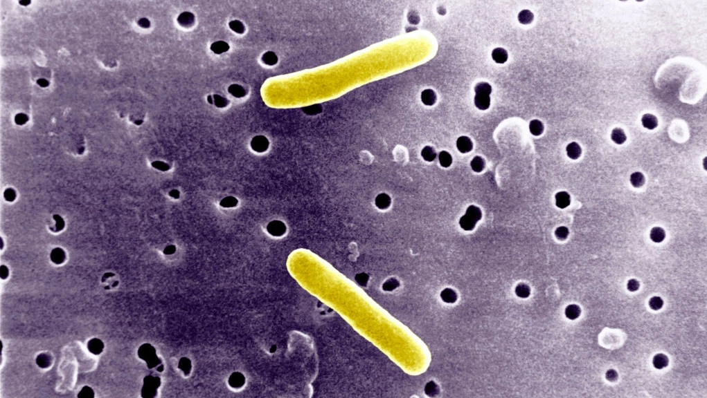Lancet study links climate change to rising salmonella drug resistance
