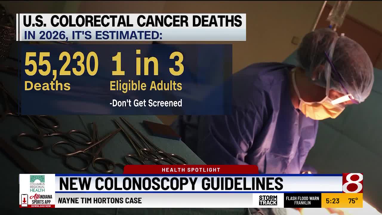 New colonoscopy guidelines