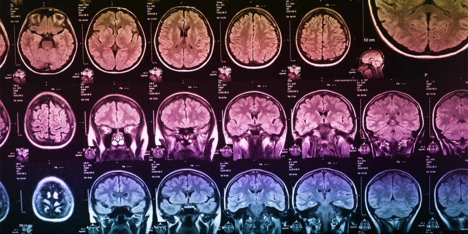 Long-term air pollution exposure linked to memory decline in Black adults
