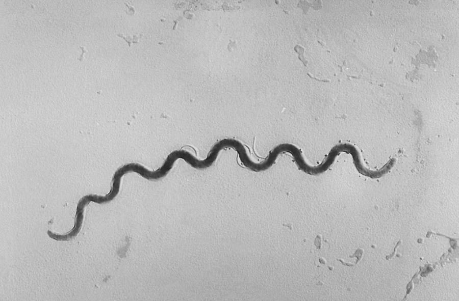 Sentara reports 42% increase in syphilis testing following new initiative