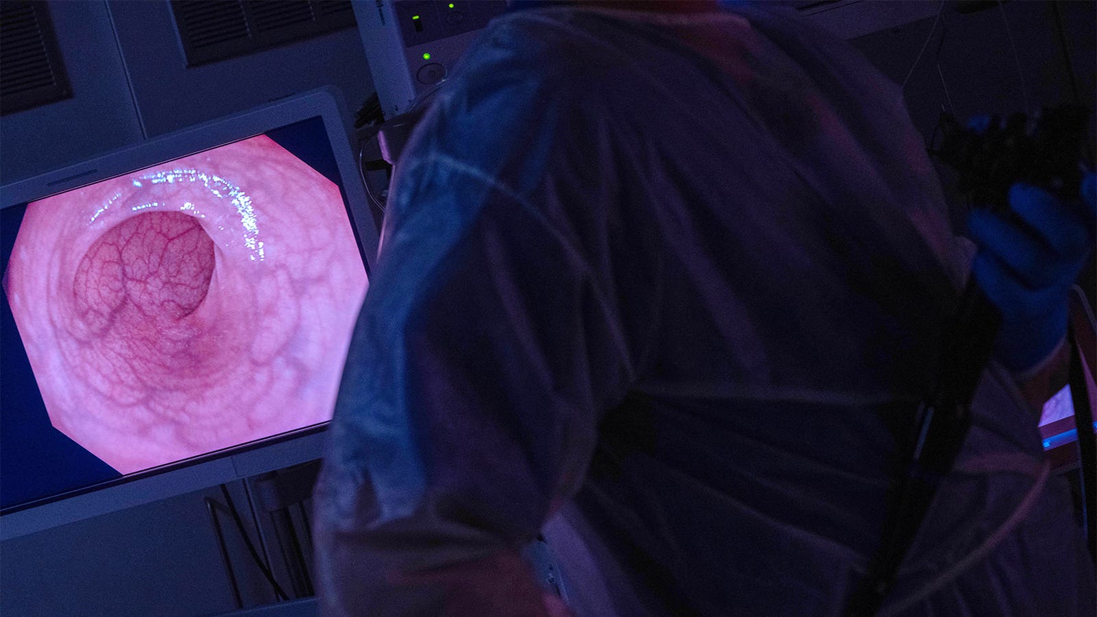 Blood test for colon cancer screening gets guideline backing