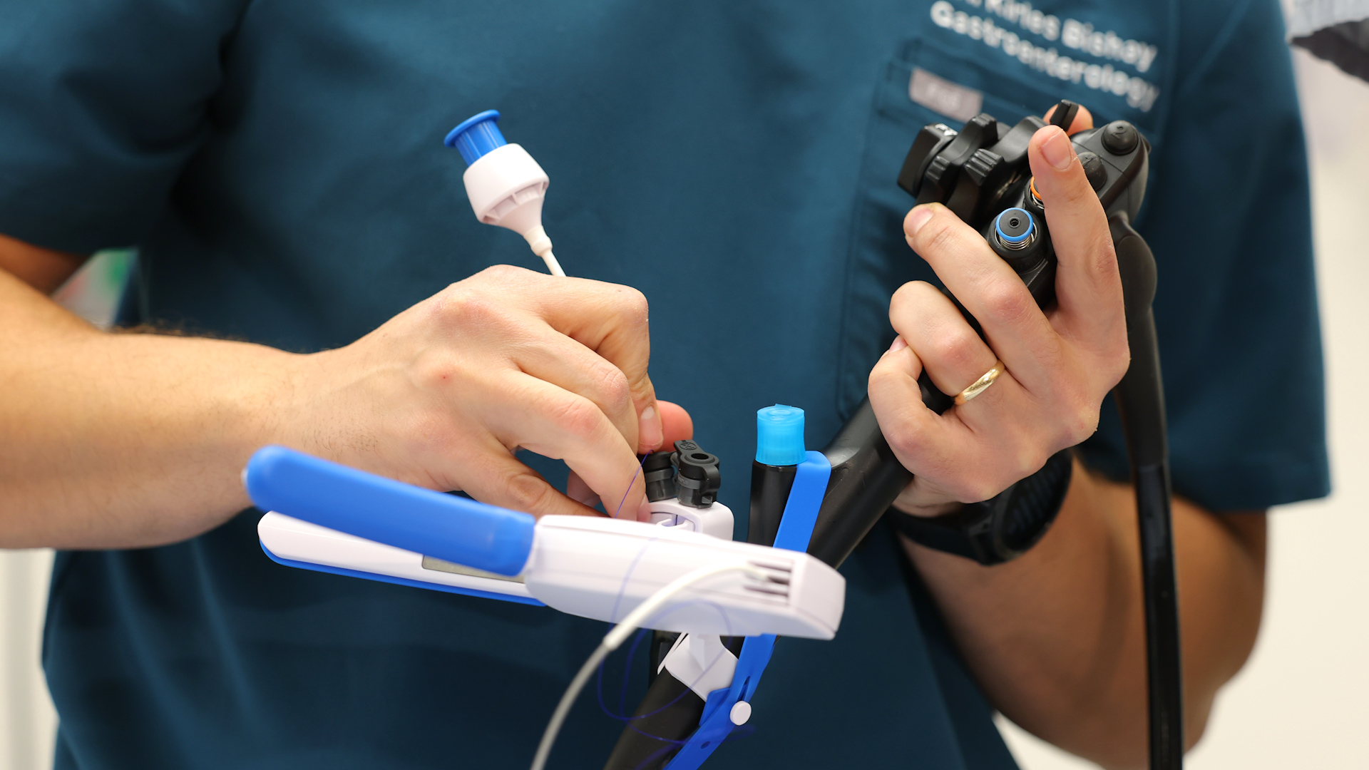 Non-surgical weight loss procedure available at Edmonton hospital