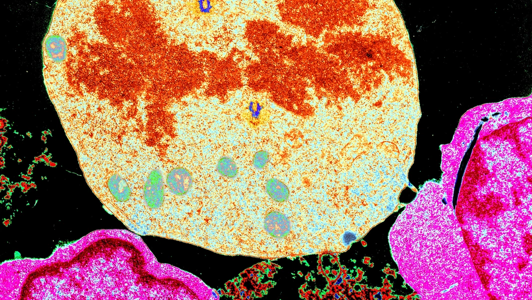 Scientists map SPD-5 activation and ancient protein networks