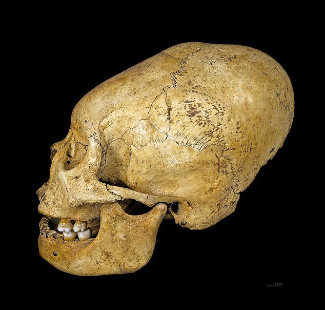 New DNA analysis of mysterious 'conehead' mummies fuels alien origin ...