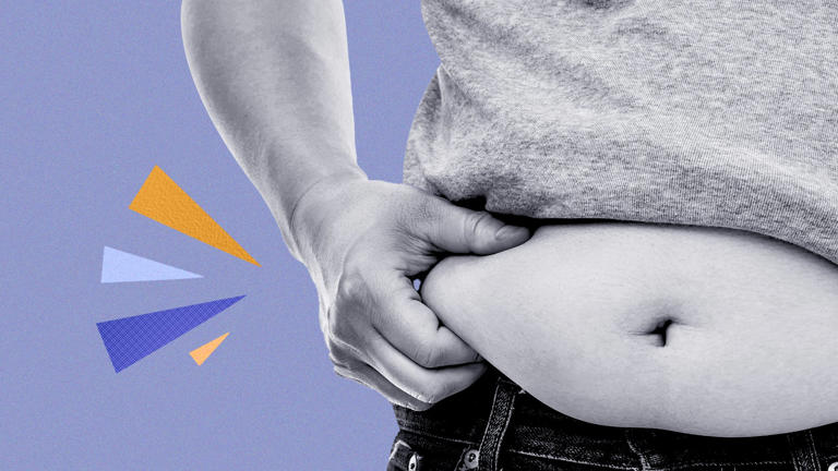 80% of 30s-40s diabetes patients have obesity