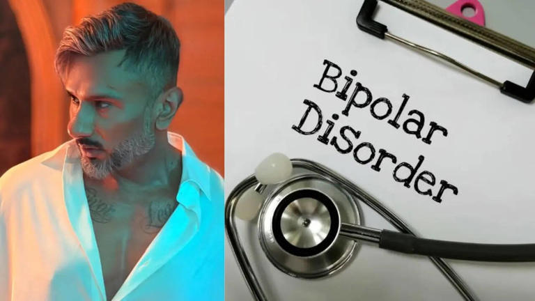 Honey Singh reveals bipolar disorder left him bald - how stress ...