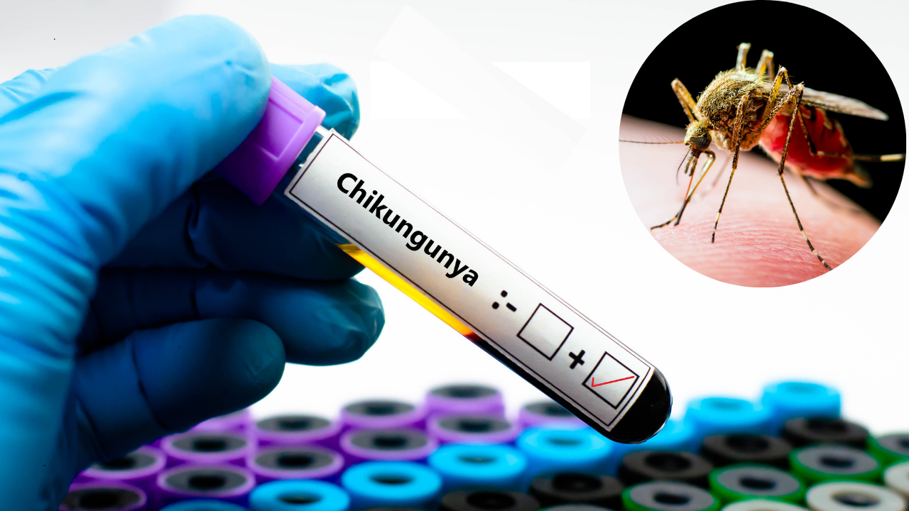 Climate change fueling chikungunya spread to Europe, North America ...