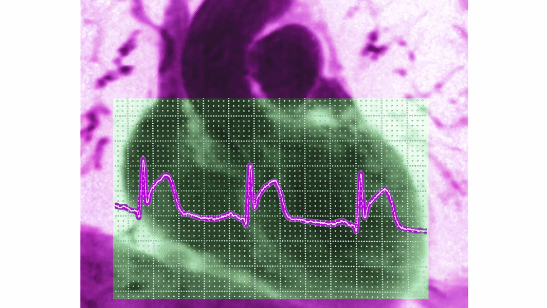 Heart health starts with the right tests