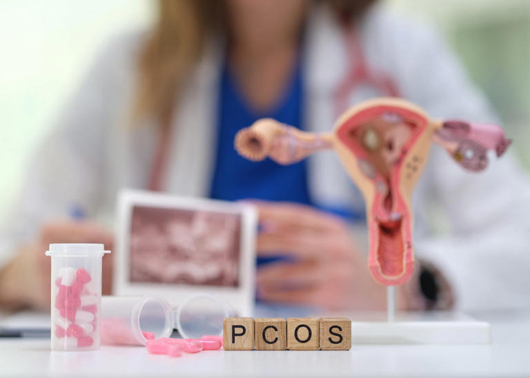 6 early signs of polycystic ovary syndrome (PCOS) that are often overlooked