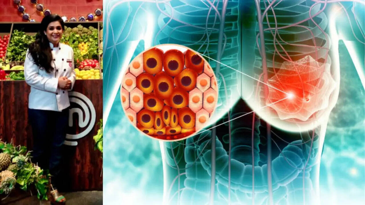 MasterChef Pankaj Bhadouria reveals breast cancer diagnosis, early ...