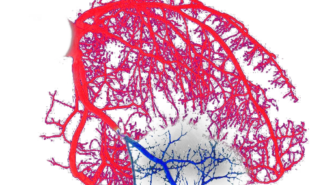 Major trial questions beta blocker benefits after uncomplicated heart ...