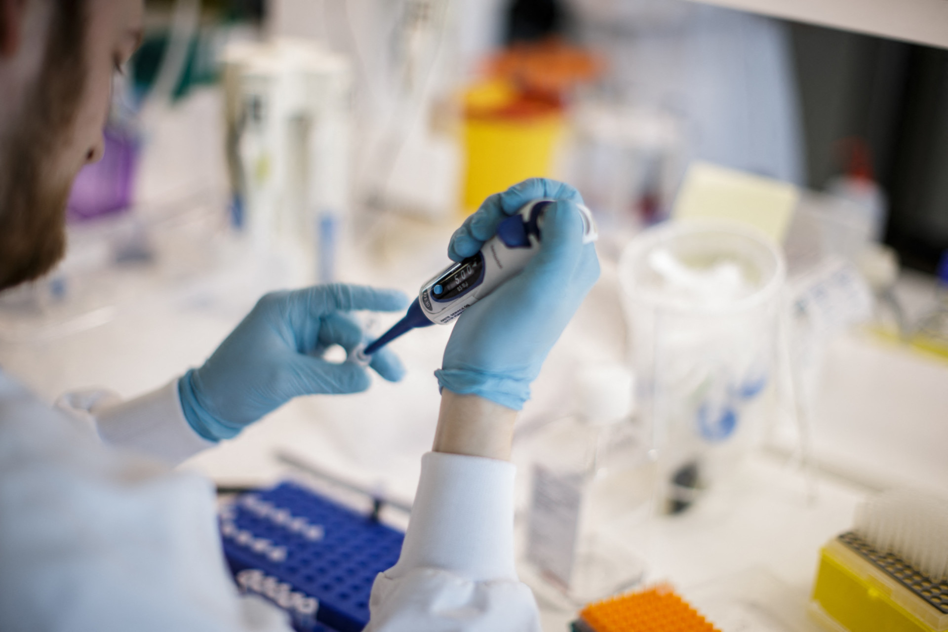 AI has helped scientists discover first new antibiotic in 60 years