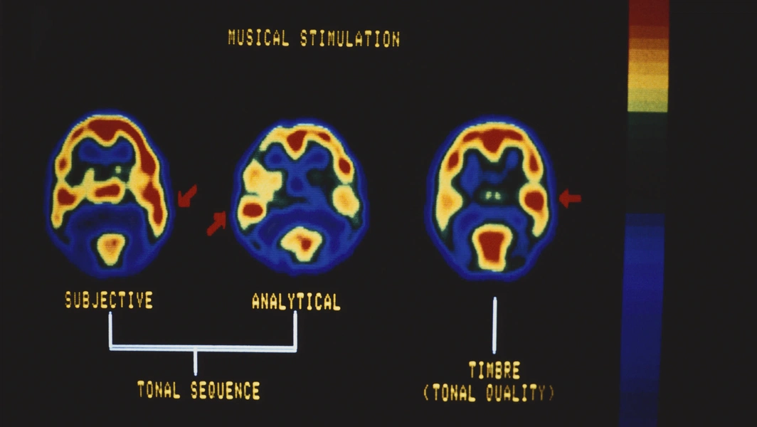 How calming music rewires your stress response