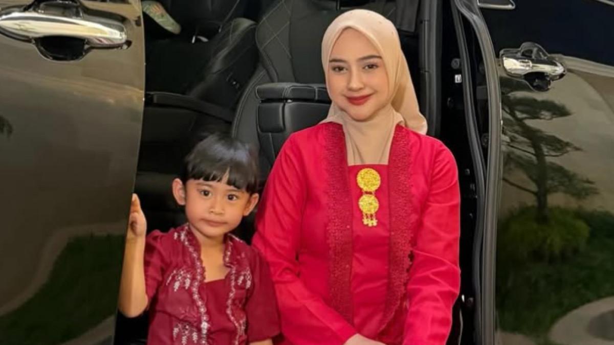 Ria Ricis curhat hidung oplasnya kena tabok Moana, janda Teuku Ryan ...