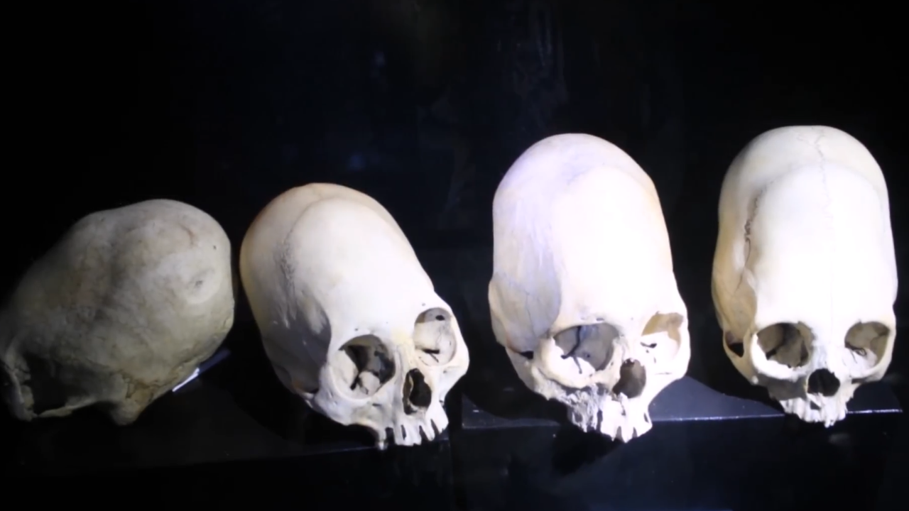 Ancient elongated skulls Peru and Bolivia: An exam
