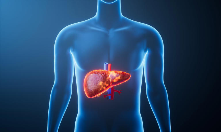 Scientists pinpoint new way to identify those at risk of liver disease ...