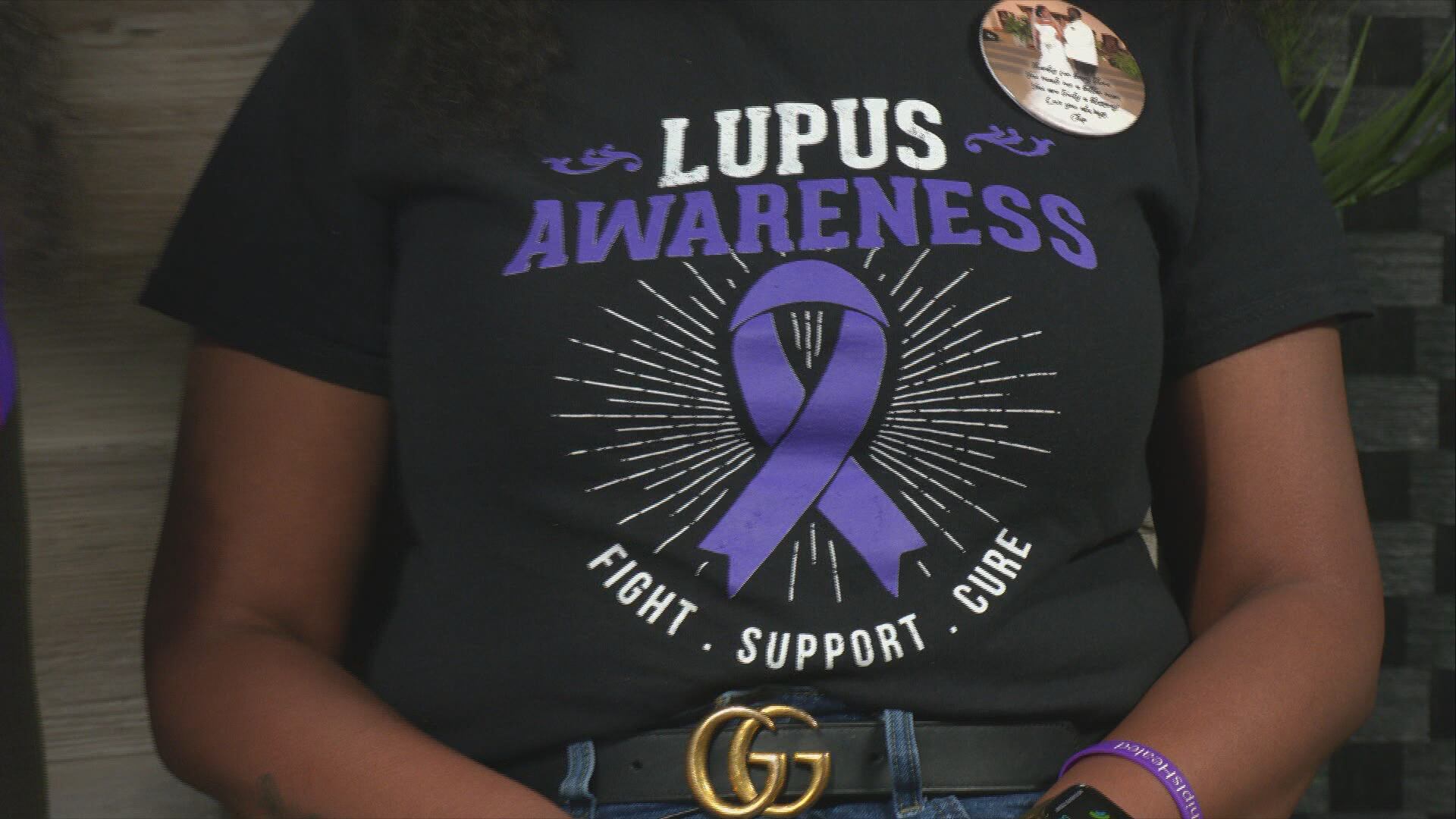 Lacing up for Lupus awareness walk planned for Saturday in Albany