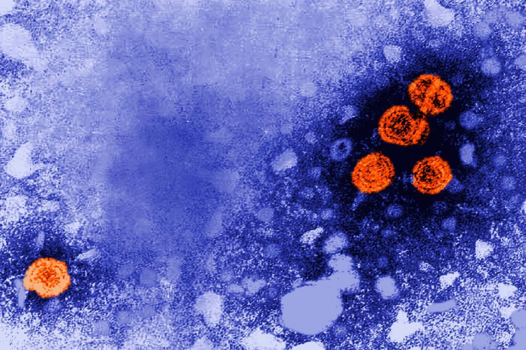 Experimental hepatitis B drug might offer 'functional cure' for a ...