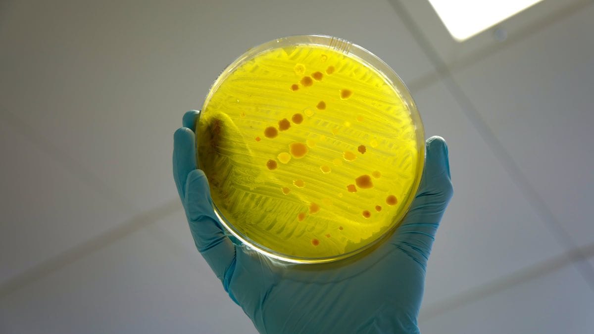 Does climate change worsen antimicrobial resistance? Lancet study says ...
