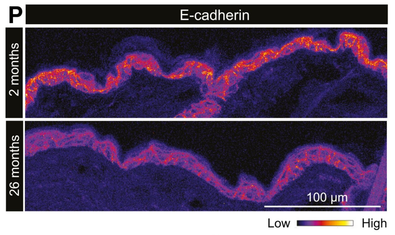 Unprecedented view inside live stem cells reveals aging process and ...