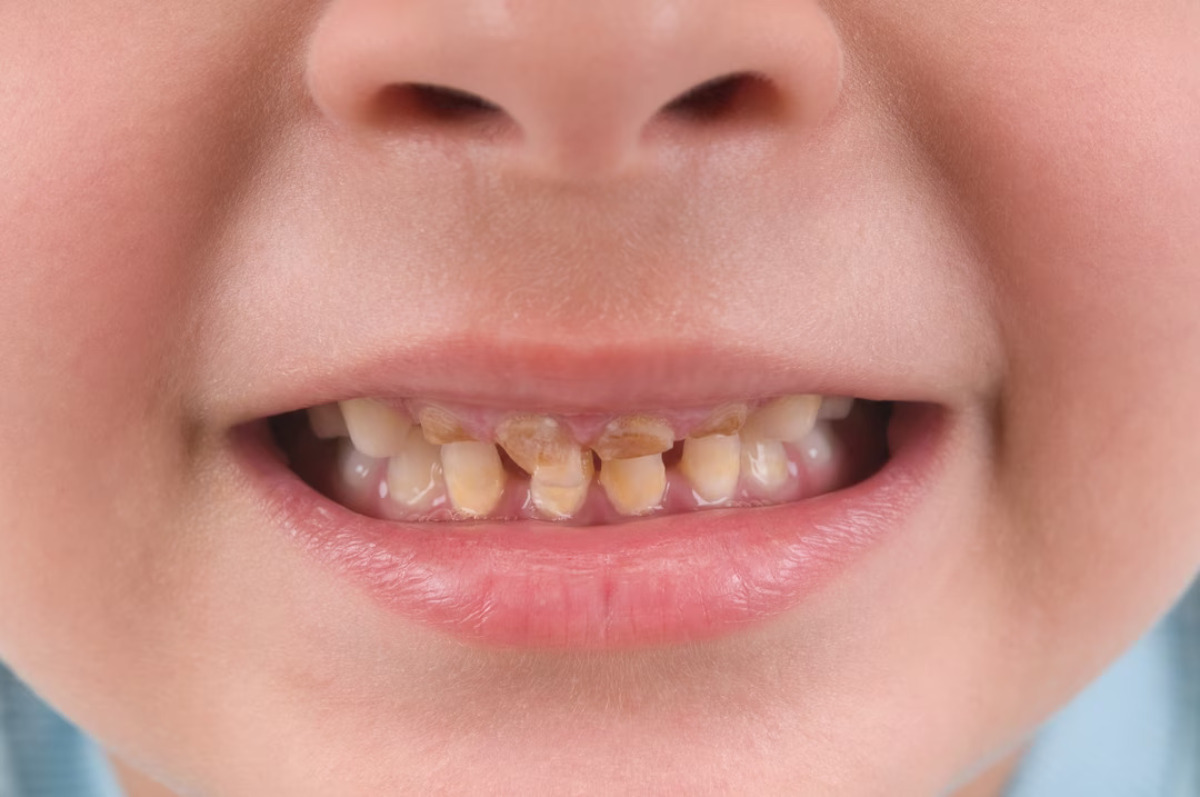 Say goodbye to dental implants: the pill that regrows and repairs teeth