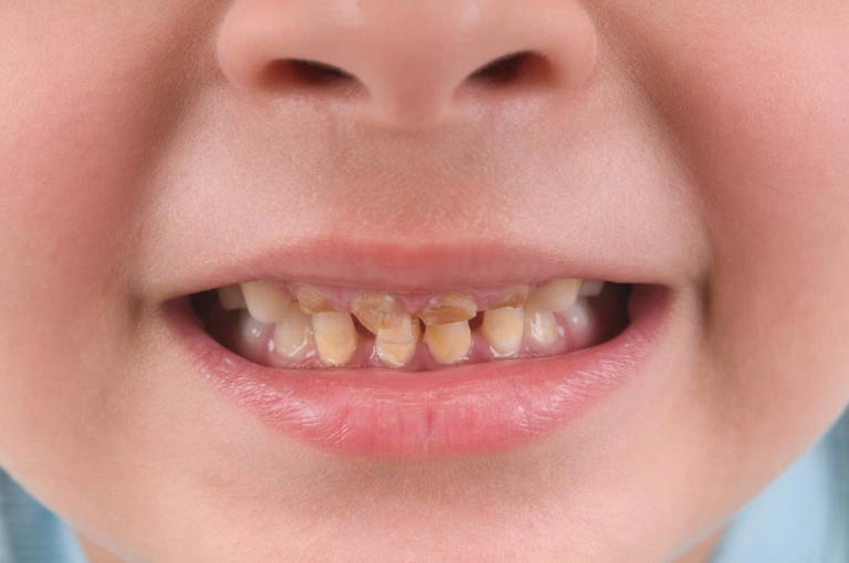 Say goodbye to dental implants: the pill that regrows and repairs teeth