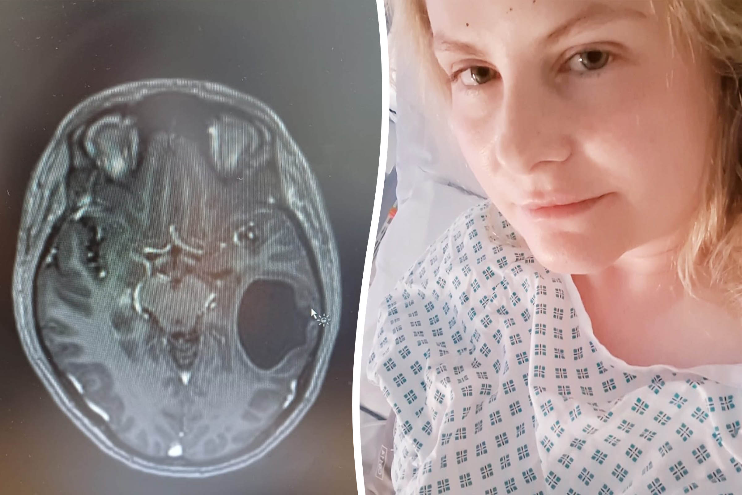 Woman remortgages home to fund treatment for terminal brain cancer