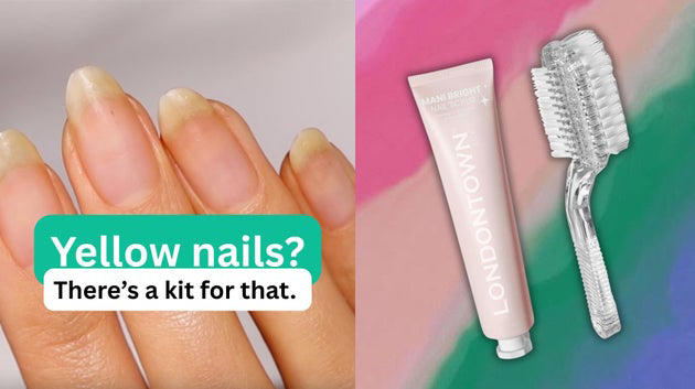 Yes, nails can turn yellow from age — this $24 kit helps fix it