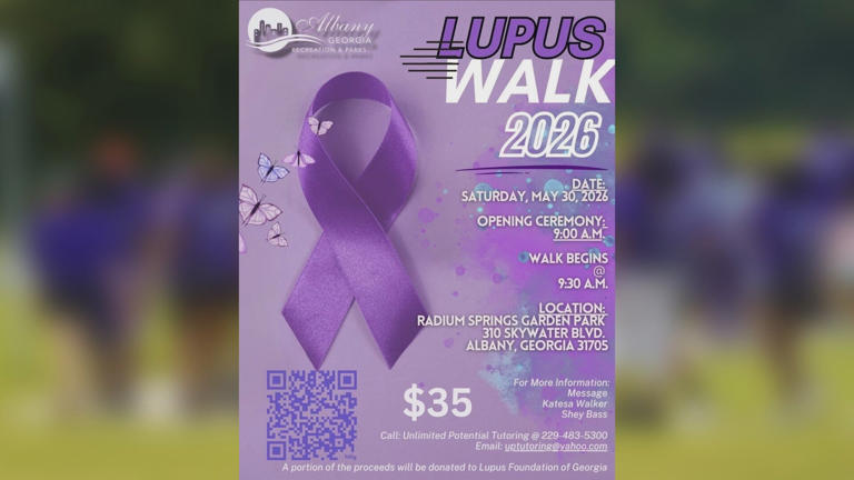 Lacing up for Lupus awareness walk planned for Saturday in Albany